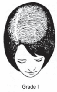 Ludwig Female Hair Loss Scale: Stages & Treatment Options | Hair Growth ...